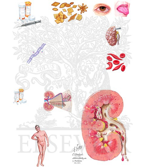 Chronic Tubulointerstitial Nephritis and Analgesic Nephropathy