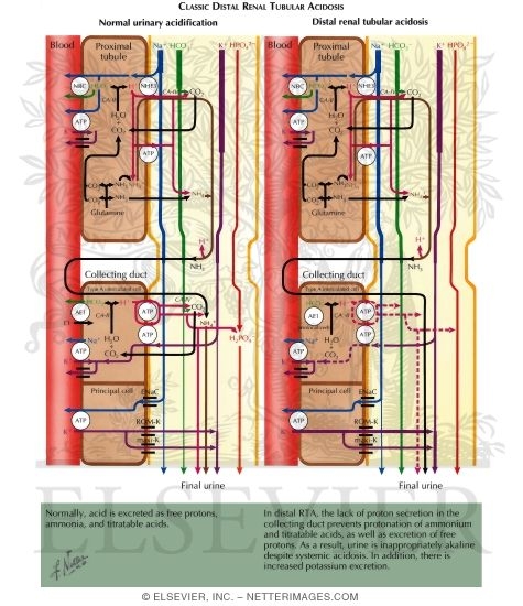 Normal Urinary Acidfication - Renal Tubular Acidosis: Proximal Tubular ...
