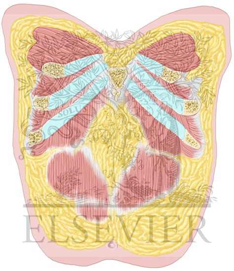 Abdomen Coronal 1