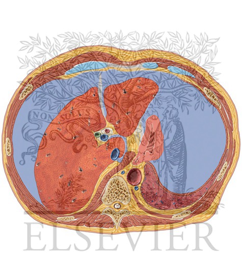 Peritoneal Cavity Abdomen Axial 3