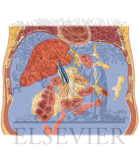 Peritoneal Cavity Abdomen Coronal 6