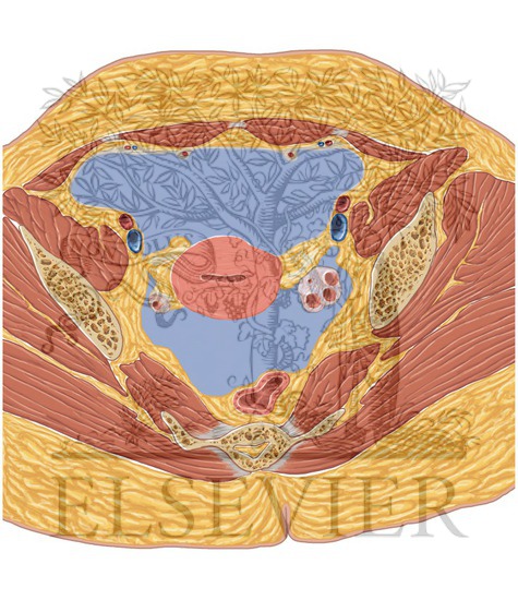 Peritoneal Cavity Pelvis Axial 4
