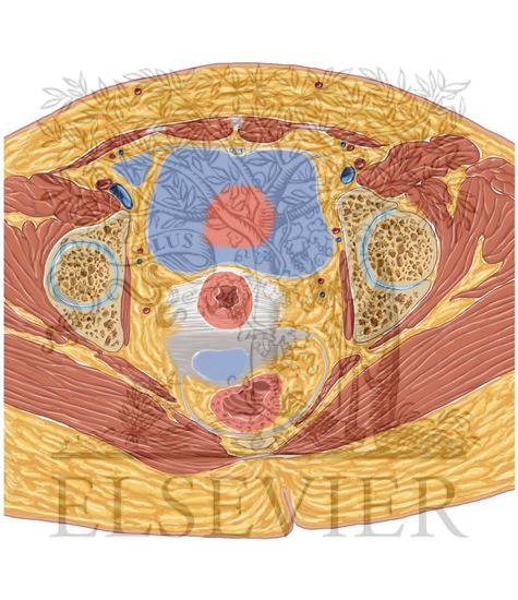 Peritoneal Cavity Pelvis Axial 7