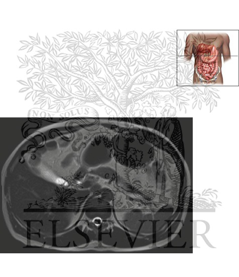 Biliary System Axial 3