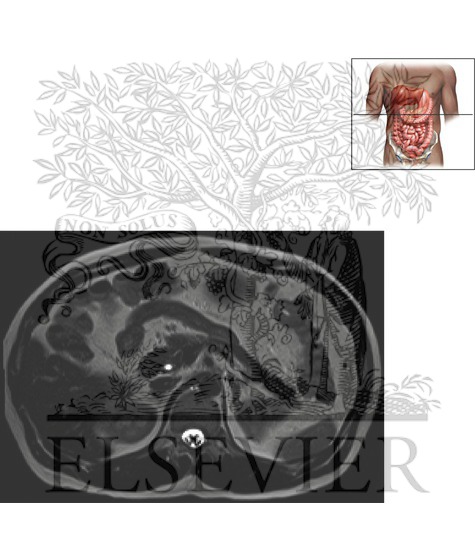 Watermarked preview of unlabeled image: Biliary System Axial 6