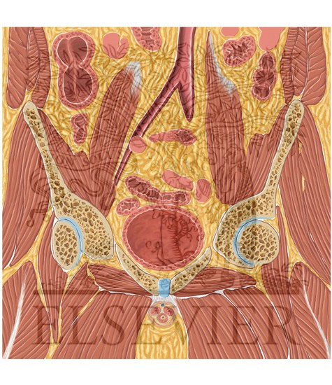 Male Pelvis Coronal 4