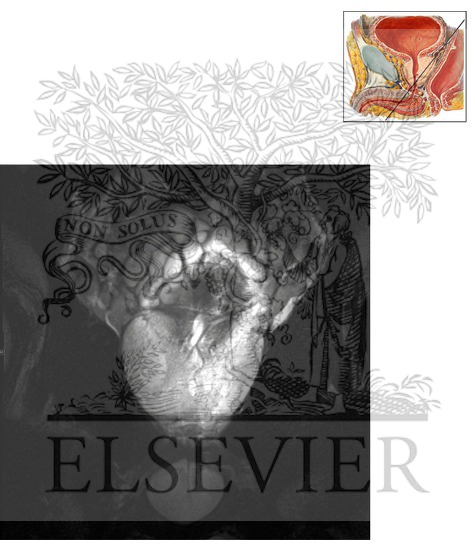 Prostate and Seminal Tract Coronal 5