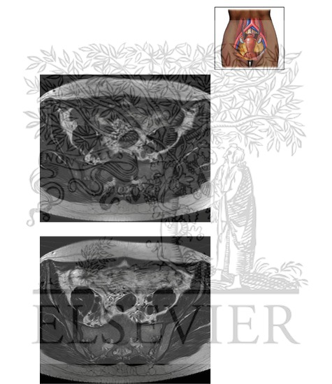 Female Pelvis Axial 2