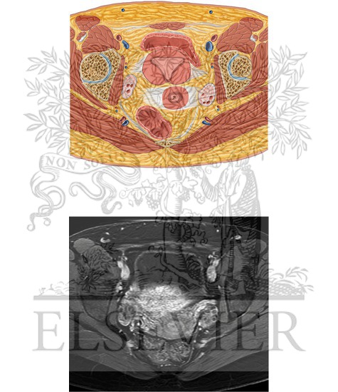 Female Pelvis Axial 7