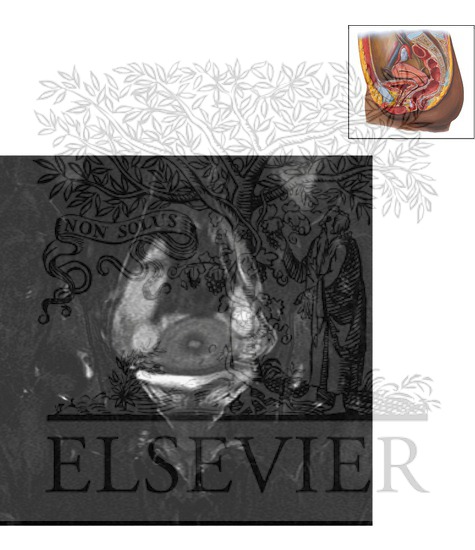 Female Pelvis Coronal 5