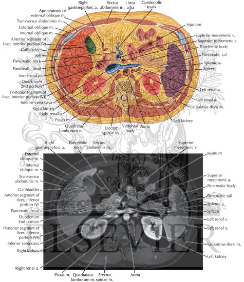 Abdomen Anatomy Mri Abdomen Axial Anatomy Free Cross Sectional