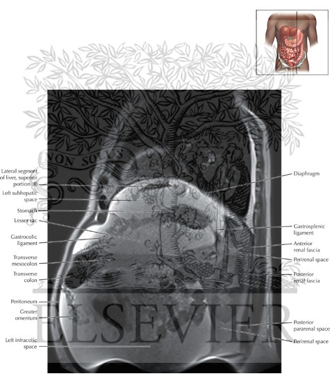 Peritoneal Cavity Pelvis Sagittal 2