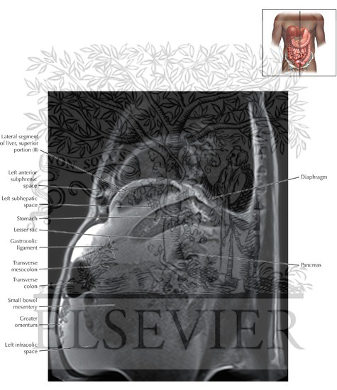 Peritoneal Cavity Pelvis Sagittal 4