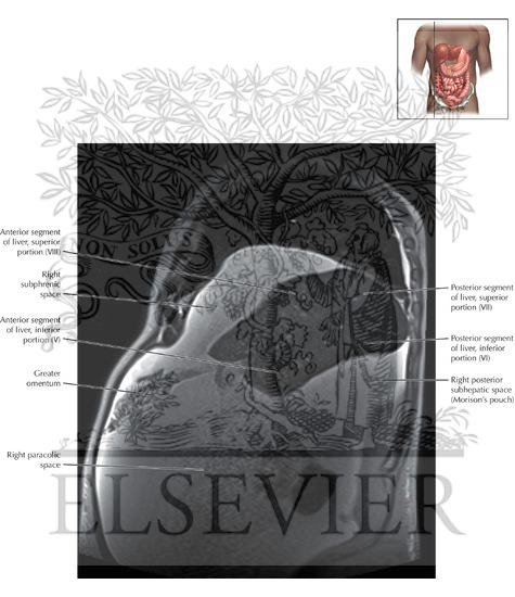 Peritoneal Cavity Pelvis Sagittal 8