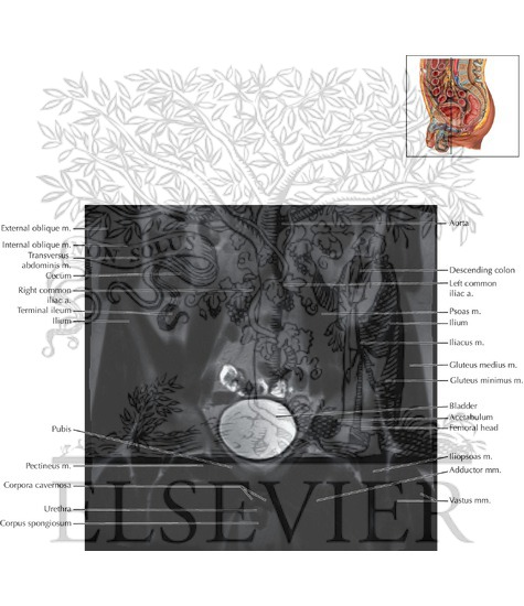 Male Pelvis Coronal 4