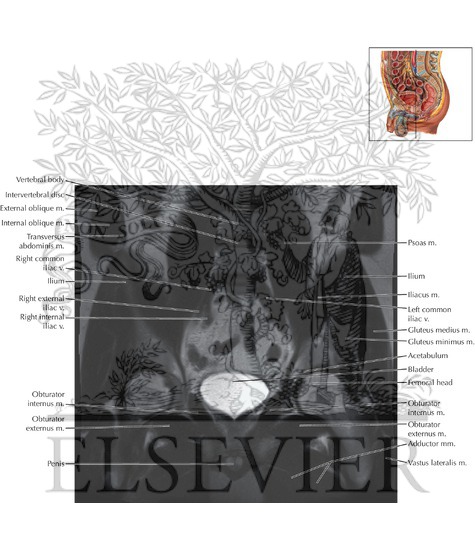 Male Pelvis Coronal 5