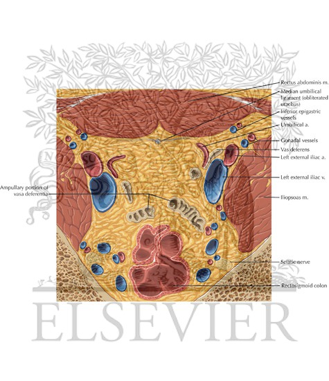Prostate and Seminal Tract Axial 1