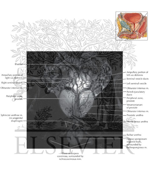 Prostate and Seminal Tract Coronal 3