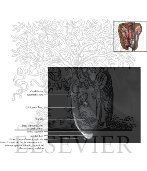 Scrotum And Testes Sagittal 2