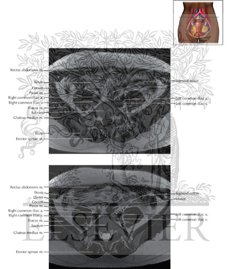 Female Pelvic Anatomy Netter