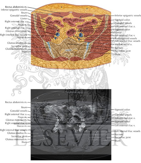 Female Pelvis Axial 2