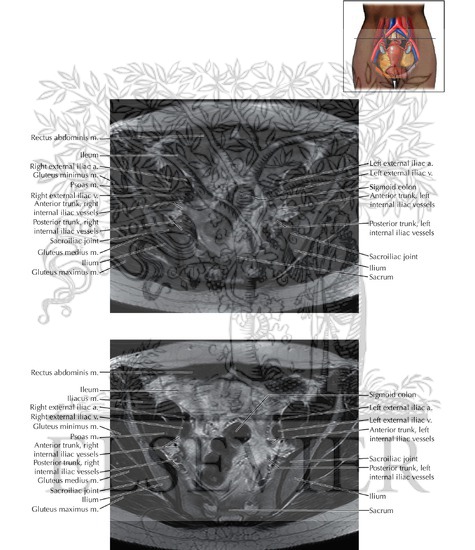 Female Pelvis Axial 3