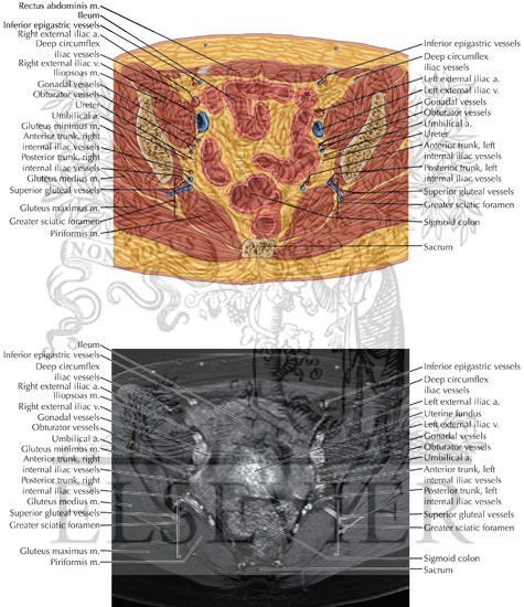 Female Pelvis Axial 4
