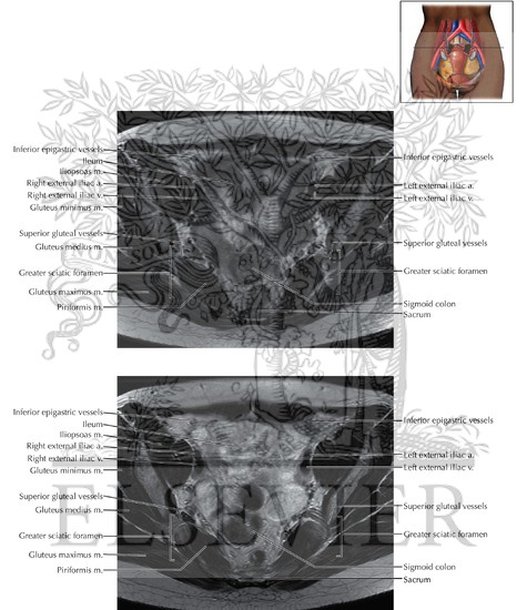 Female Pelvis Axial 4