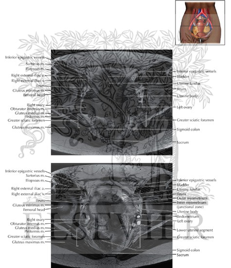 Female Pelvis Axial 6