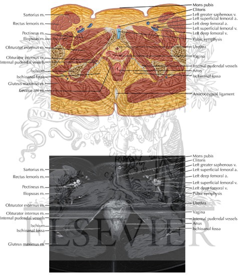 Female Pelvis Axial 11
