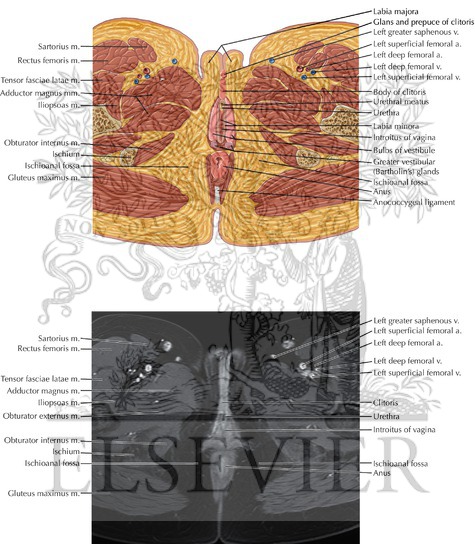 Female Pelvis Axial 12