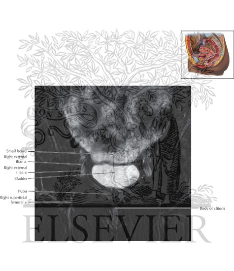 Female Pelvis Coronal 2