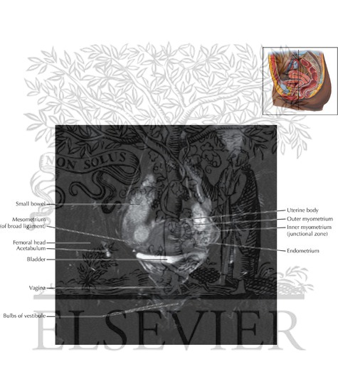 Female Pelvis Coronal 5