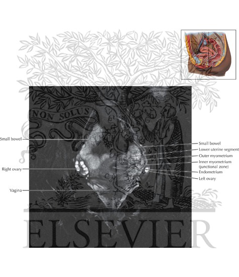 Female Pelvis Coronal 6