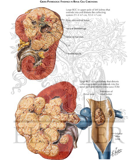labeled kidney cell