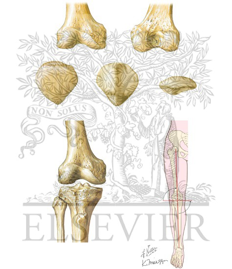 Osteology of the Knee