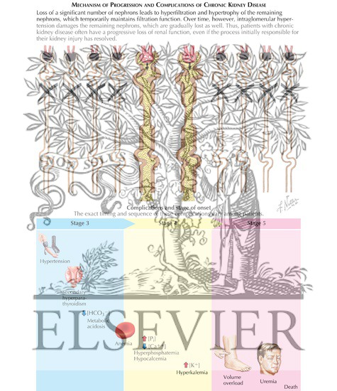 Overview of Chronic Kidney Disease: Mechanism of Progression and ...