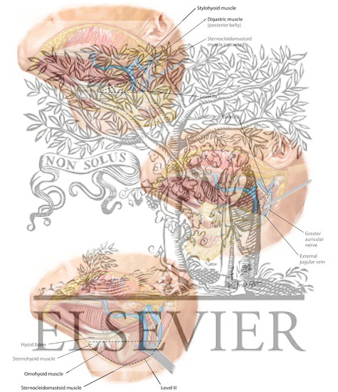 Dissection of Levels II (Upper Jugular Modal Chain) and III (Midjugular ...
