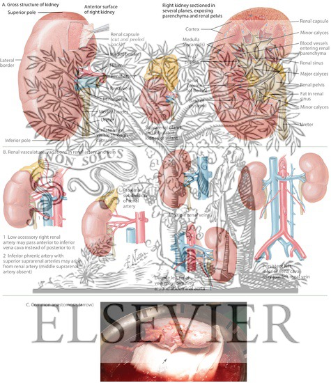 Anatomic Variations of Kidney Allograft