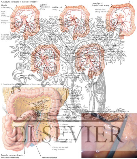 Vascular Variations in Conon; Duodenal Anatomy