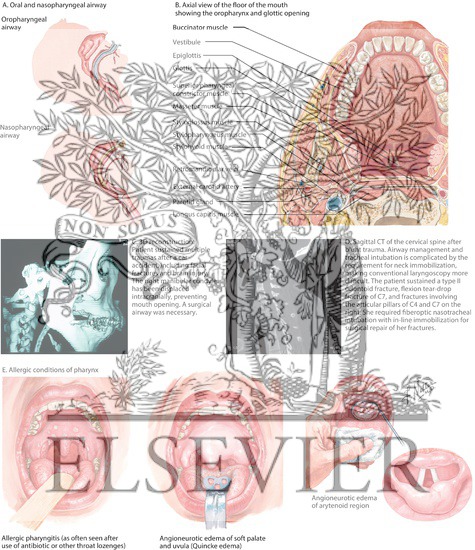 intubation view labeled