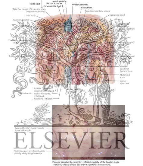 Reflected Colon and Mesentery Medially; Kidney and Gerota's Fascia ...