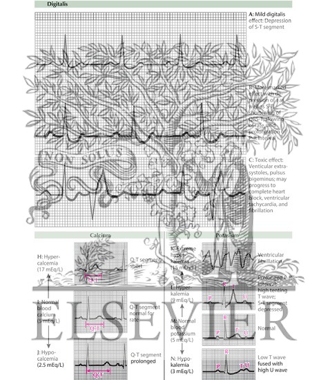 Watermarked preview of labeled image: Effect of Digitalis and Calcium ...