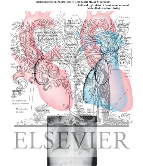 Radiology and Angiocardiography