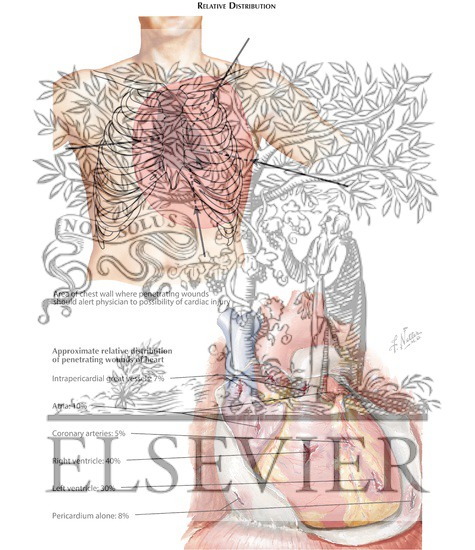 Penetrating Heart Wounds