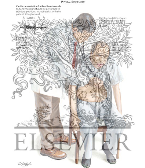 Physical Examination: Left-Sided Cardiac Heart Failure