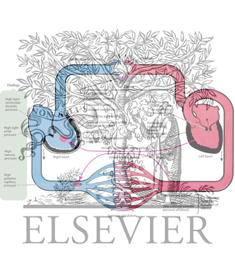 Peripheral Congestion or Edema of Cardiac Origin