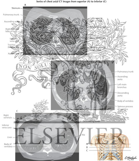 Chest Scans: Axial CT Images