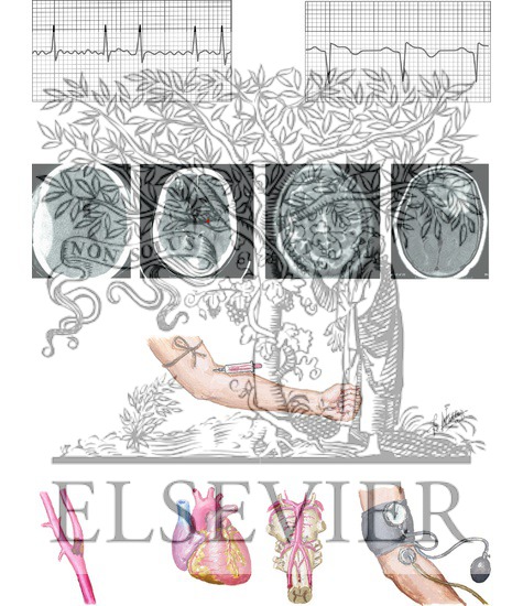 Clinical Evaluation and Therapeutic Options in Stroke (Continued)