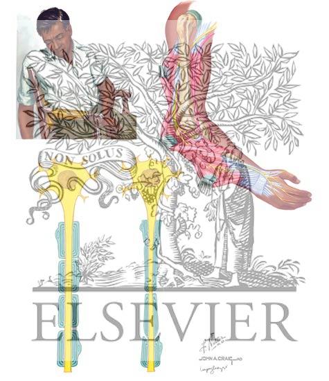 Compression Neuropathies